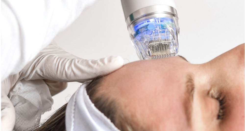 Secret Rf Microneedling - Ibeier Technology