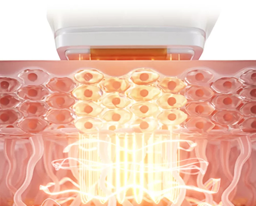 Best Bipolar RF Machine for Facial Skin Tightening Beauty - Ibeier ...