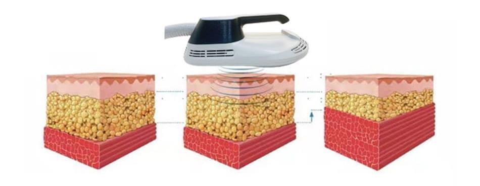 Muscle Building Machines - Ibeier Technology